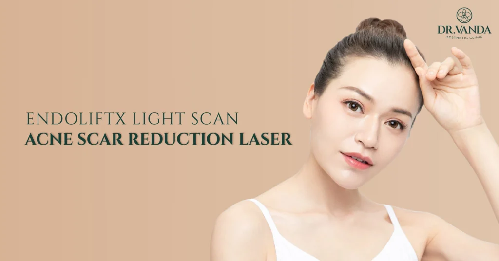 EndoliftX Light Scan Acne Scar Reduction Laser