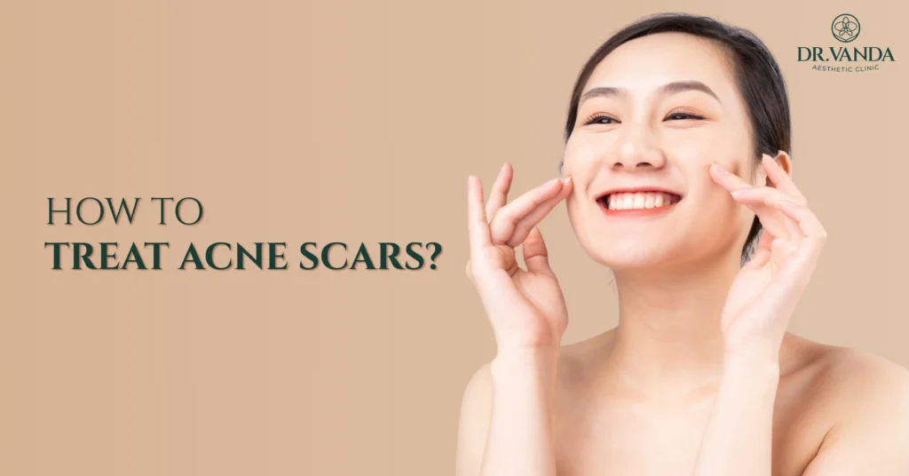 Acne Scar Treatments : Types, Effectiveness, And Safety